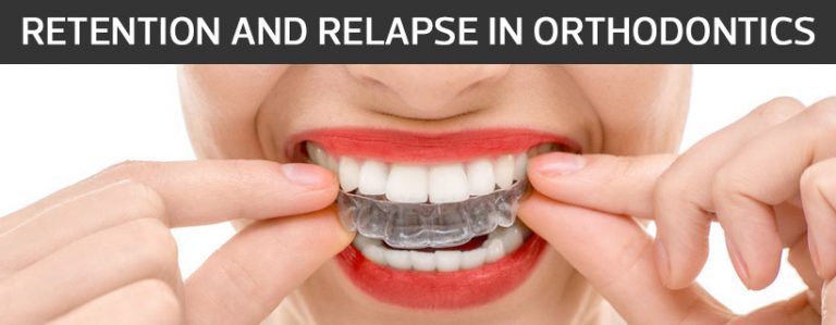 Retention & Relapse in Orthodontics - ICPA Health Products Ltd