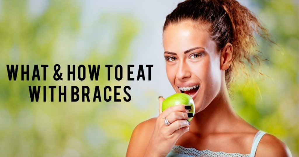 Expert Advice: What and How to Eat with Braces - ICPA Health Products Ltd